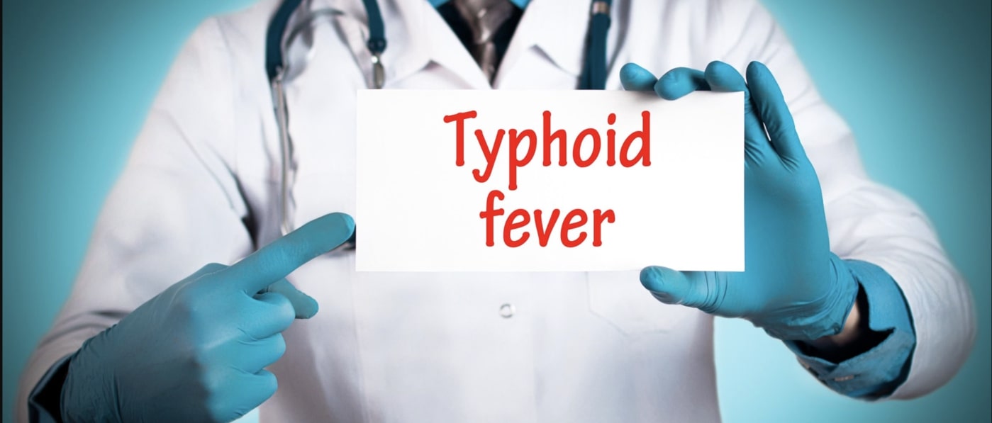 Typhoid cause, Symptoms of Typhoid and Treatment | Apollo Hospitals