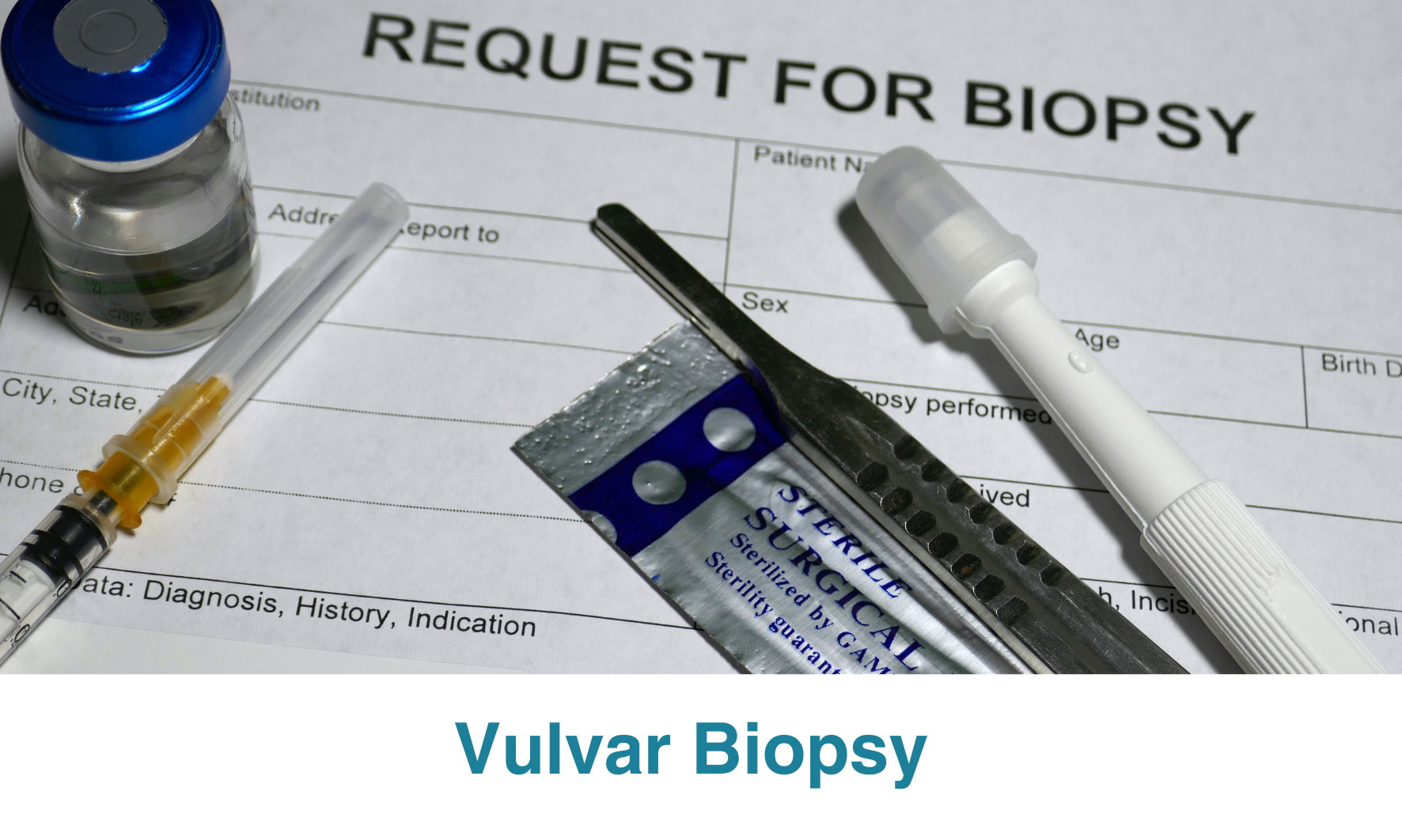 Biopsie vulvy | Nemocnice Apollo