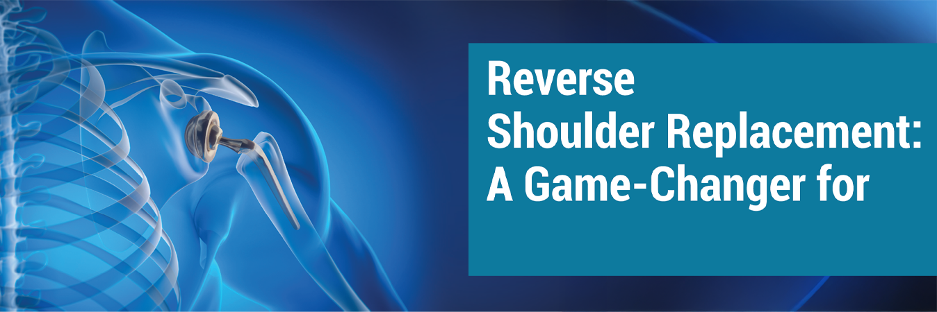 Ano ang duling na mata at paano ito maitatama? | Mga Ospital ng Apollo