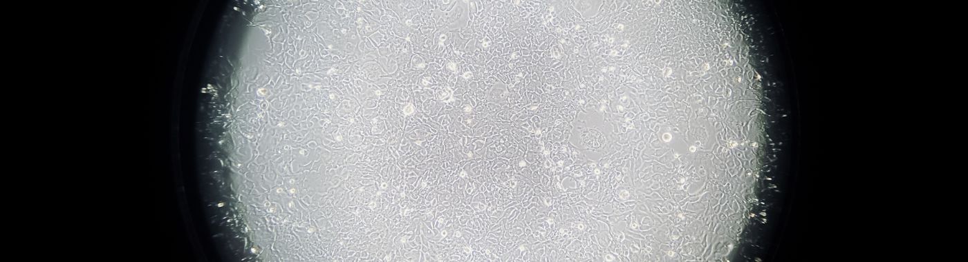 Kanser sa Gastrointestinal | Mga Ospital ng Apollo