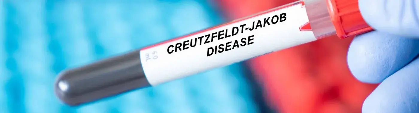 Creutzfeldt Jakob Disease - Causes, Symptoms, Diagnosis, and Treatment