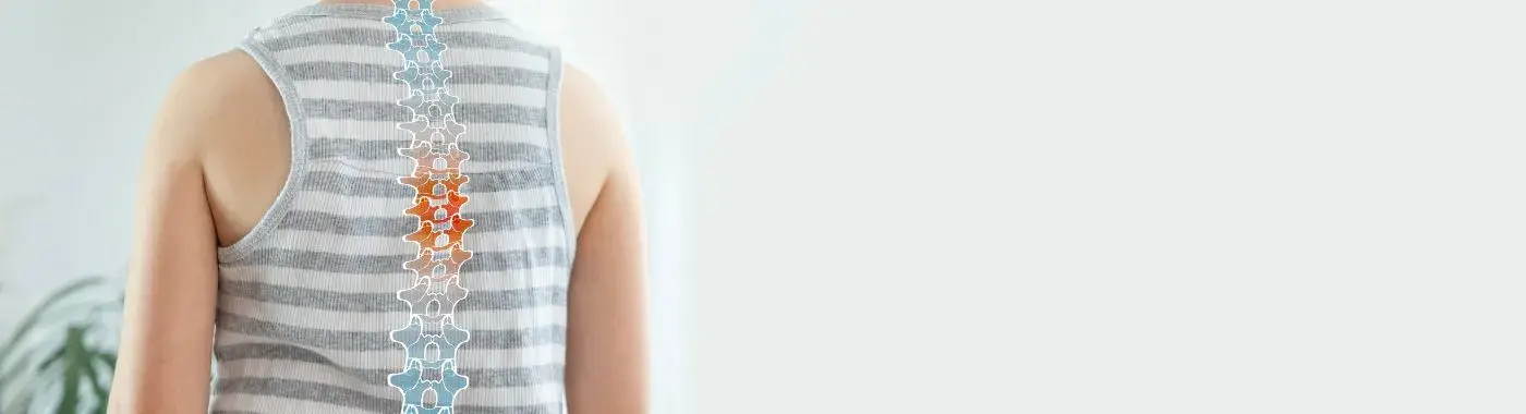 Sandifer Syndrome - Causes, Symptoms, Diagnosis, and Treatment